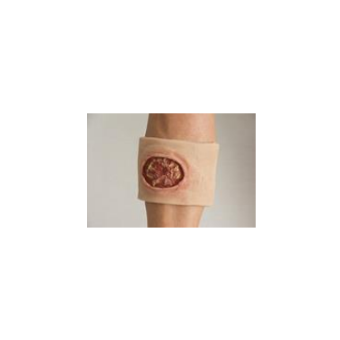 Rood-gele wond, 18 x10 cm - Skills Meducation