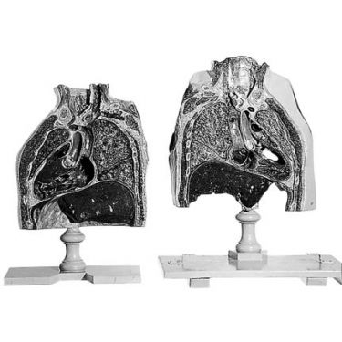 Frontaaldoorsnede van borstkas, 3-delig - Skills Meducation