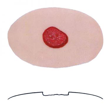 Rode wond - model A - Skills Meducation