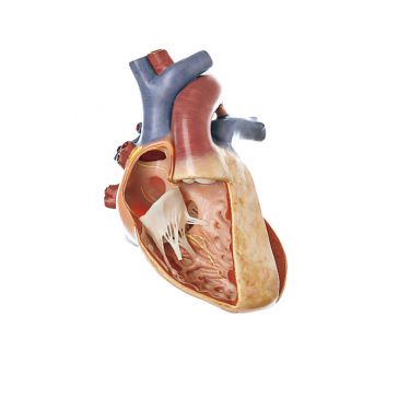 Hart met transpositie van de grote vaten, 3x vergroot - Skills Meducation